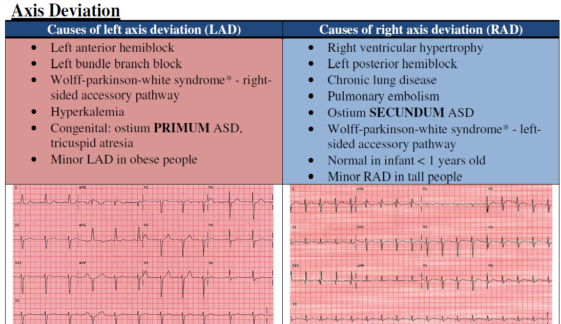 MEDICINE PAKISTAN Causes Of Axis Deviation On ECG medicine-pakistan-causes-of-axis-deviation-on-ecg