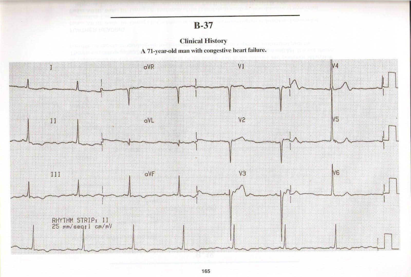 MBBS Medicine (Humanity First): ECG Interpretations MBBS Medicine (Humanity First): ECG Interpretations