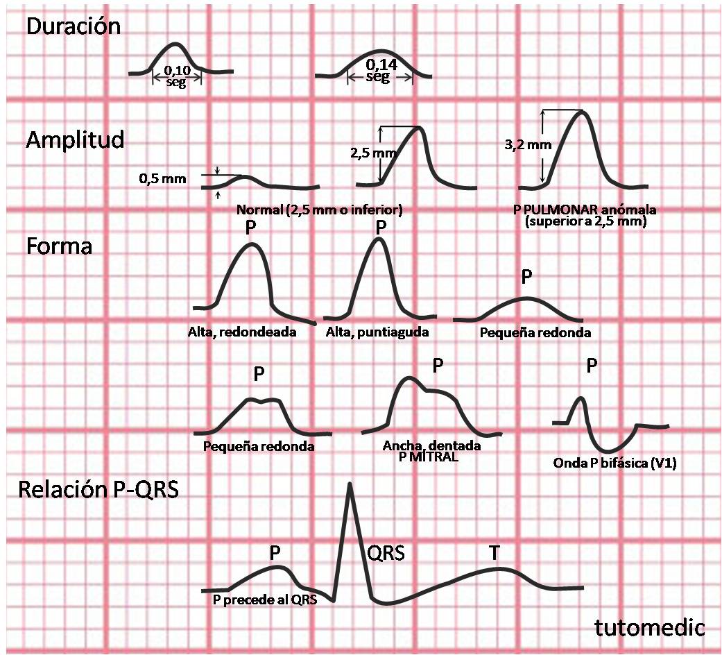 Tutomedic: RUTINA DE INTERPRETACIÓN DEL ECG:4- Onda P Tutomedic: RUTINA DE INTERPRETACIÓN DEL ECG:4- Onda P