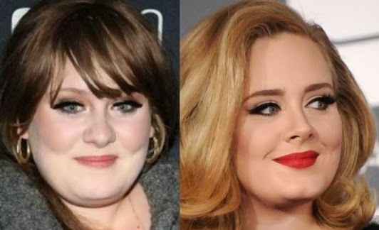 Did Adele have Nose Job Plastic Surgery Before and After Photos