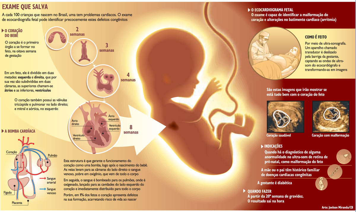 Gerando Saúde Gestante: Ecocardiograma Fetal, o exame que salva! Gerando Saúde Gestante: Ecocardiograma Fetal, o exame que salva!