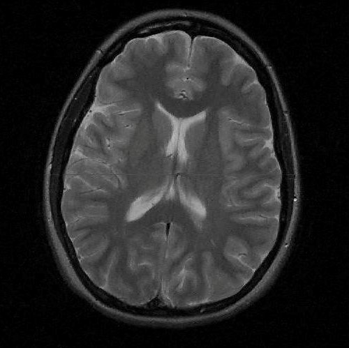 Parallel Computing In MRI Image Reconstruction OpenBiomedical parallel-computing-in-mri-image-reconstruction-openbiomedical