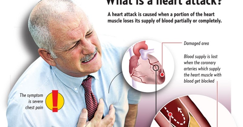 HEALTH PROJECT NOW Ways To Avoid A Heart Attack health-project-now-ways-to-avoid-a-heart-attack