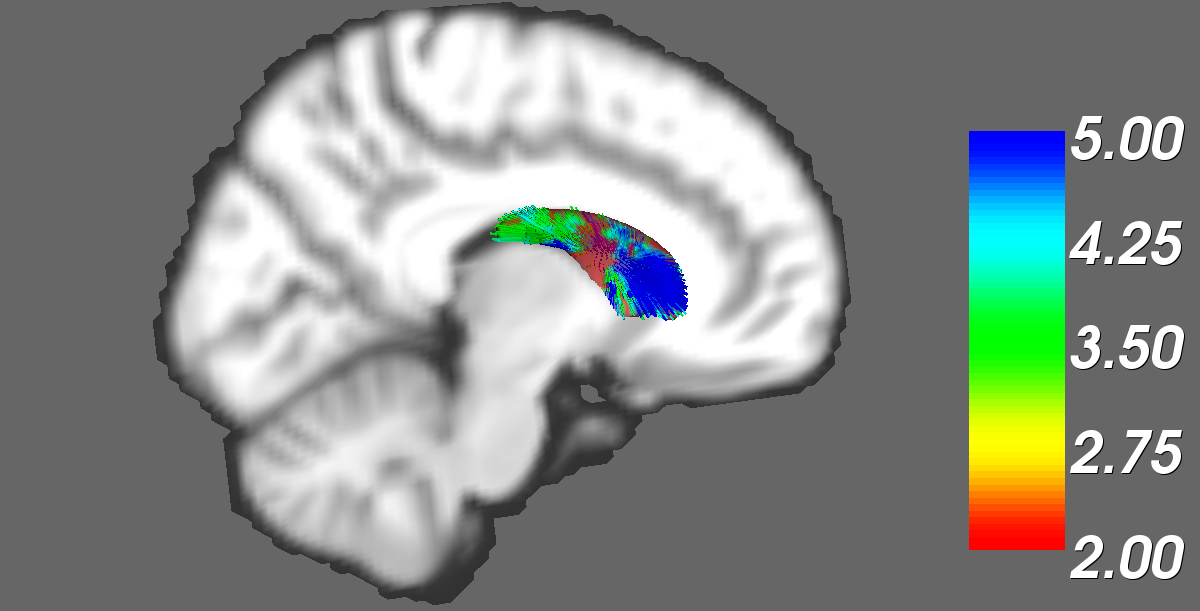 Neuroimaging Made Easy : Batching FSL tools and utilities using Applescript "5" (FIRST)