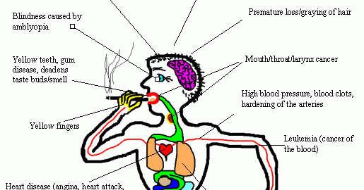 Live Natural !!: STOP SMOKING, START REPAIRING Live Natural !!: STOP SMOKING, START REPAIRING