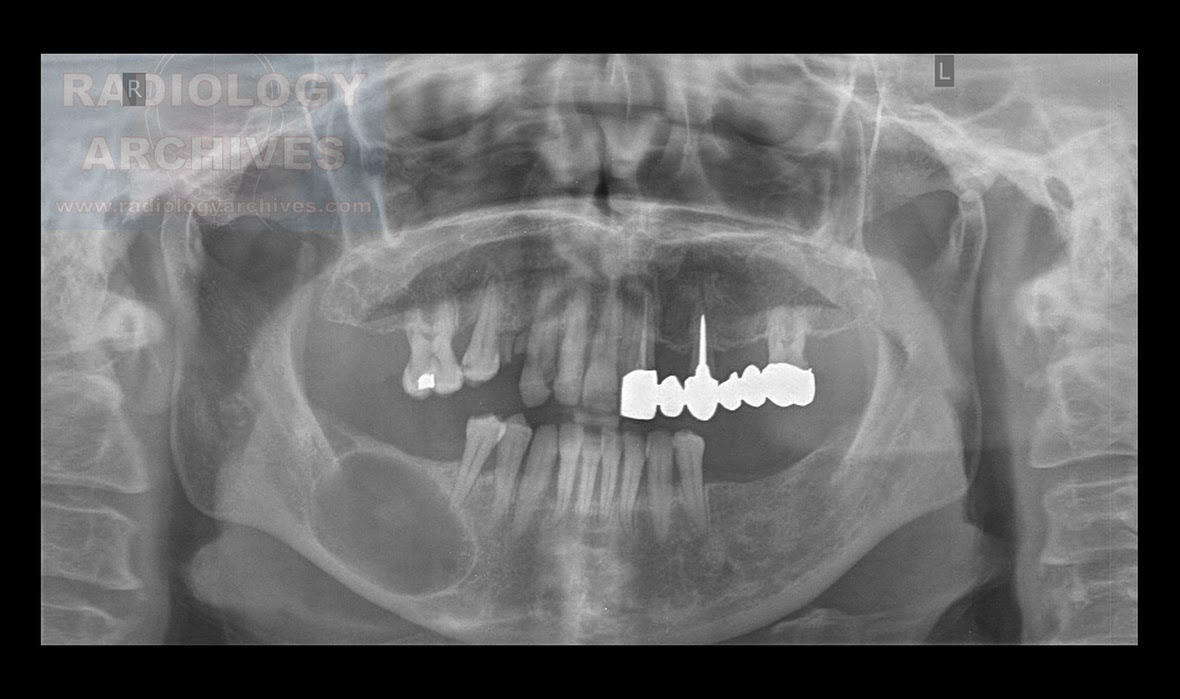 Radiology Archives: Ιανουαρίου 2013