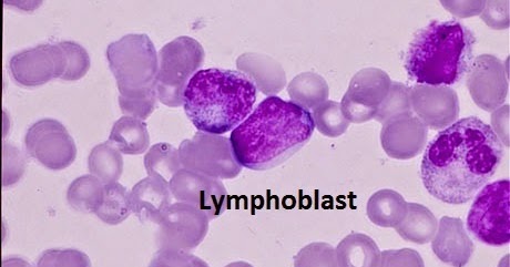 Lab Atlas: Lymphoblast