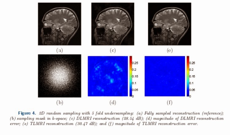 Nuit Blanche: Efficient Blind Compressed Sensing and $\ell_0$ Sparsifying Transform Learning