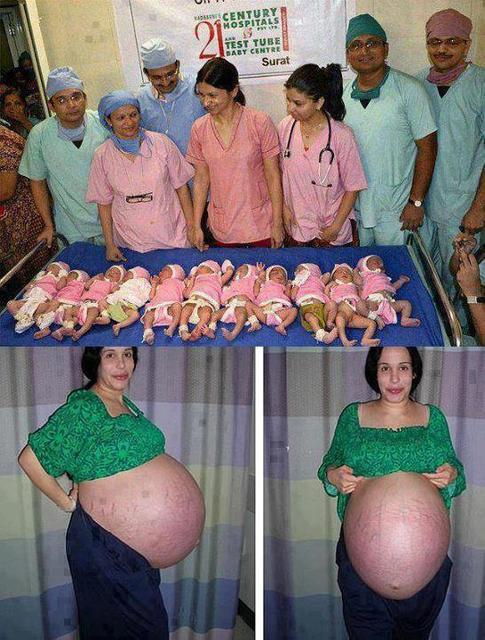 Seorang Ibu Melahirkan 11 Bayi Sekaligus Seorang Ibu Melahirkan 11 Bayi Sekaligus