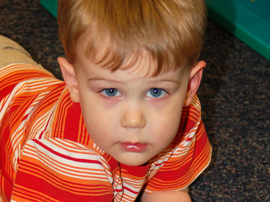 Hey Look Something Shiny Facial Characteristics Of Autism hey-look-something-shiny-facial-characteristics-of-autism