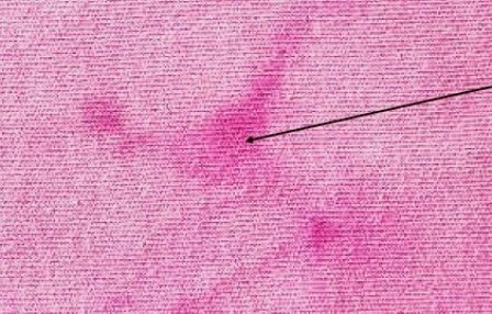 Dyeing Faults|Textile With Me