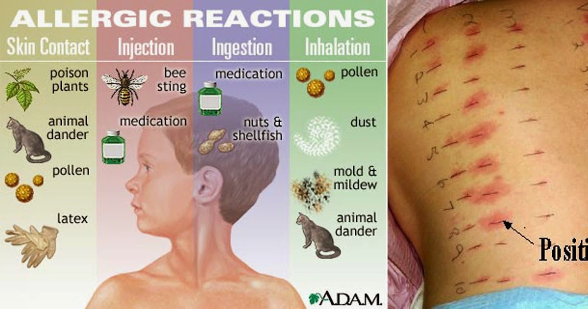 As Many Exceptions As Rules Cold Receptors Come In From The Cold as-many-exceptions-as-rules-cold-receptors-come-in-from-the-cold