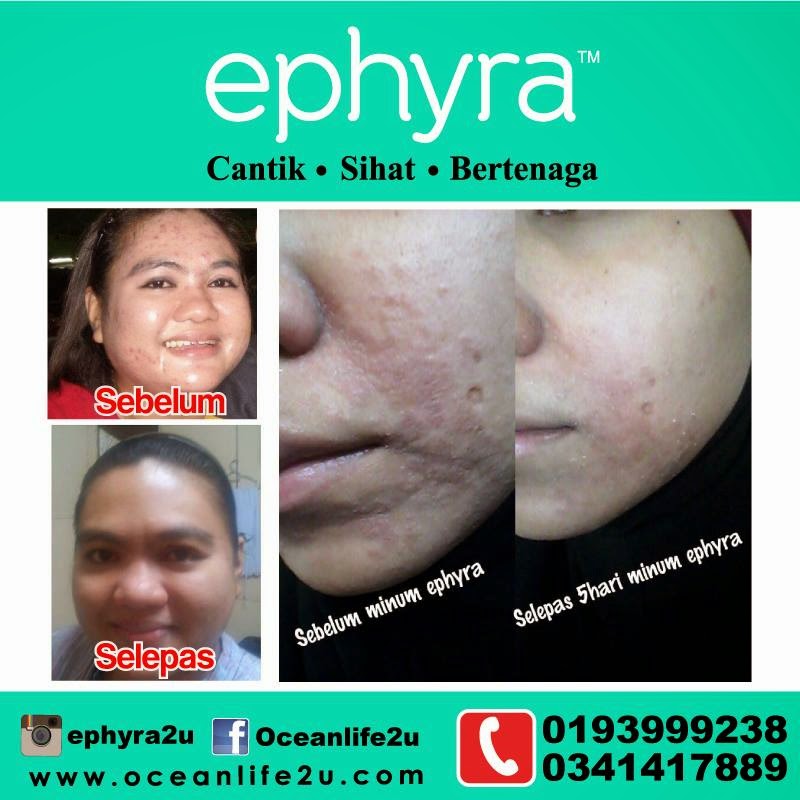 CikLilyPutih The Lifestyle Blogger: Promosi EPHYRA Sempena 2nd Anniversary MEGA SALE Dan ...