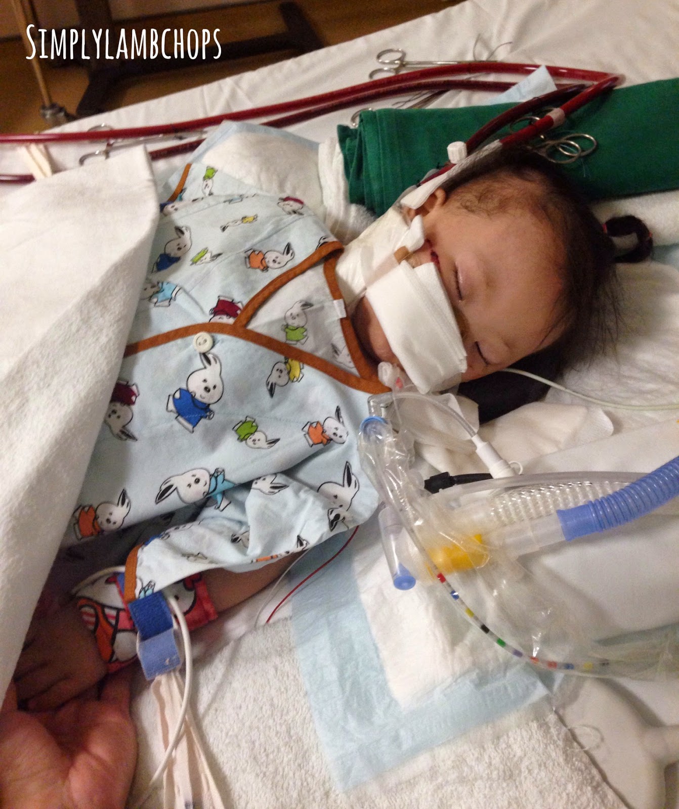 All about K: Our ECMO survivor! - Simply Lambchops