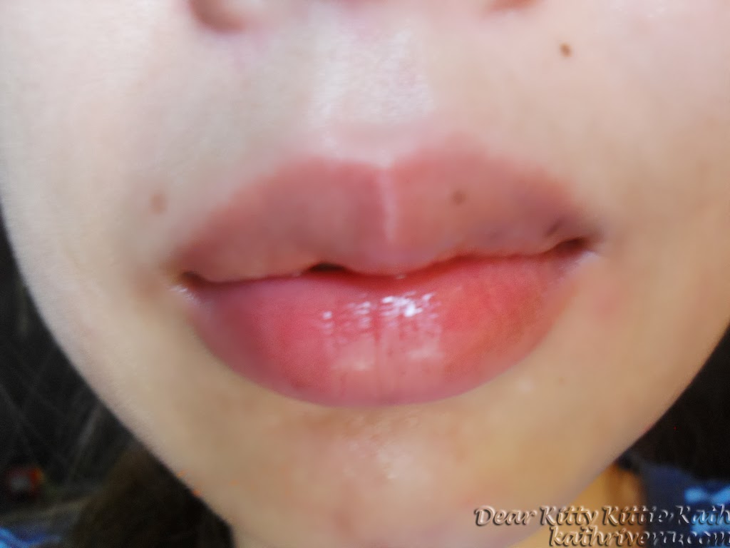 Download Free Dry Red Patch On Bottom Lip Software Managerdiary download-free-dry-red-patch-on-bottom-lip-software-managerdiary