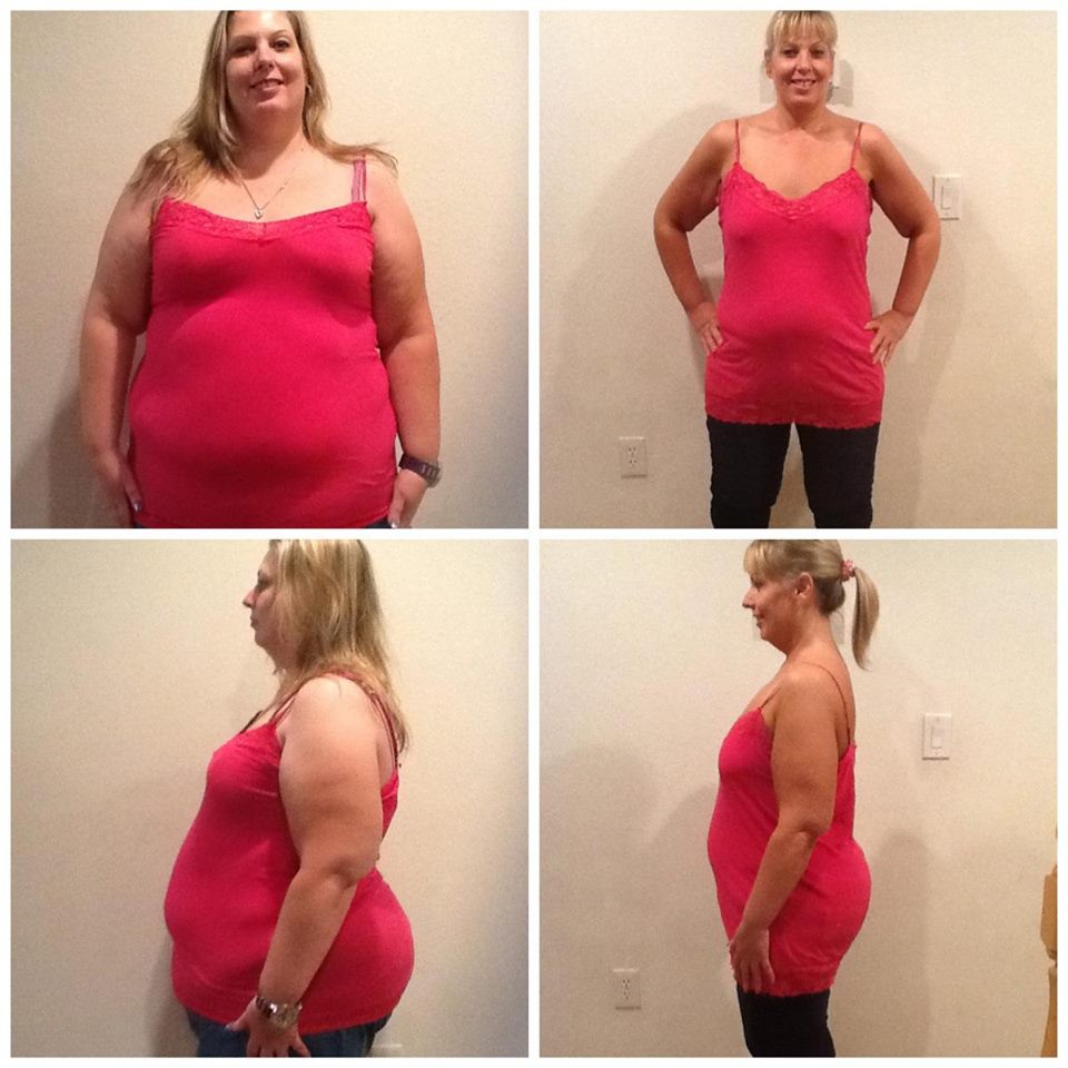 TONYA S VIDEO BLOG GASTRIC SLEEVE SURGERY tonya-s-video-blog-gastric-sleeve-surgery