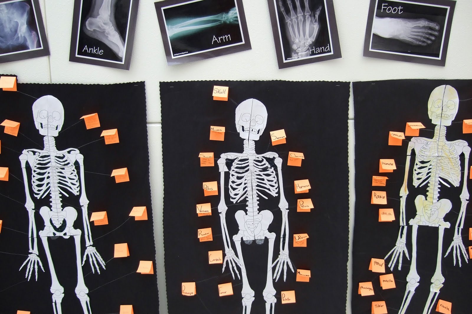 The Inspired Classroom: Skeletal System