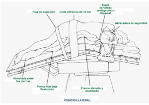 POSICIONES QUIRURGICAS: POSICIÓN LATERAL