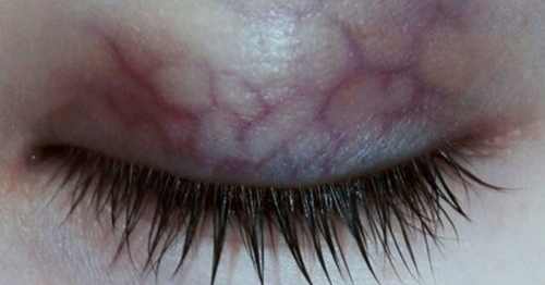 Planitikos.gr || Επιστημονική ενημέρωση: Η αποχή από το Σεξ