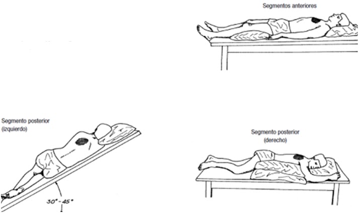 Drenaje Postural; Drenaje Pulmonar Postural; Drenaje Postural del Pulmón; Drenaje Respiratorio ...