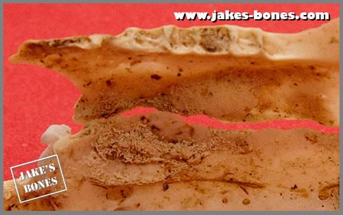 Strange bones #14: Two weird bone pathologies : Jake's Bones