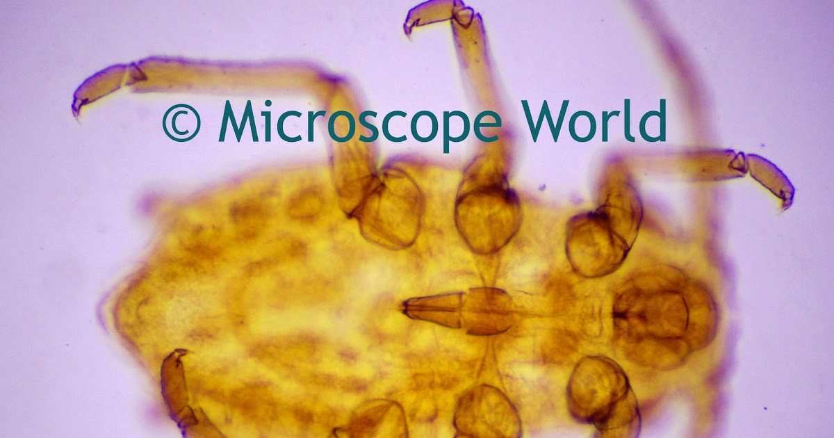 Microscope World Blog: Dry Mount versus Wet Mount Microscope Slides Microscope World Blog: Dry Mount versus Wet Mount Microscope Slides