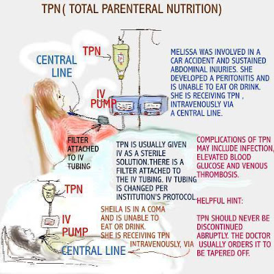 Dear Nurses: TPN ADMINISTRATION IN THE TRAUMA PATIENT