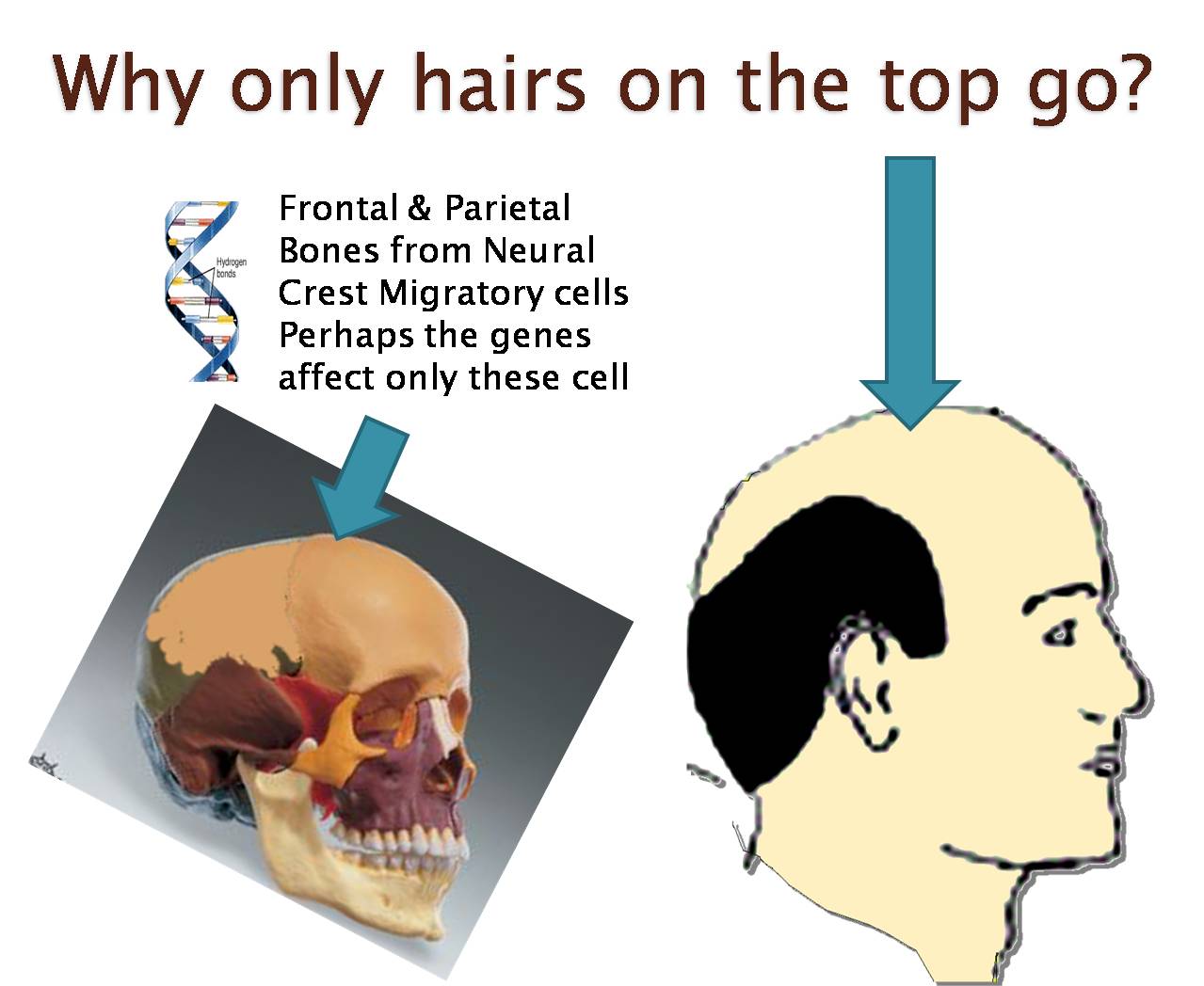 Good Bye Hair Loss - Hair Loss Tips & Advice Online: Why male pattern ... Good Bye Hair Loss - Hair Loss Tips & Advice Online: Why male pattern ...