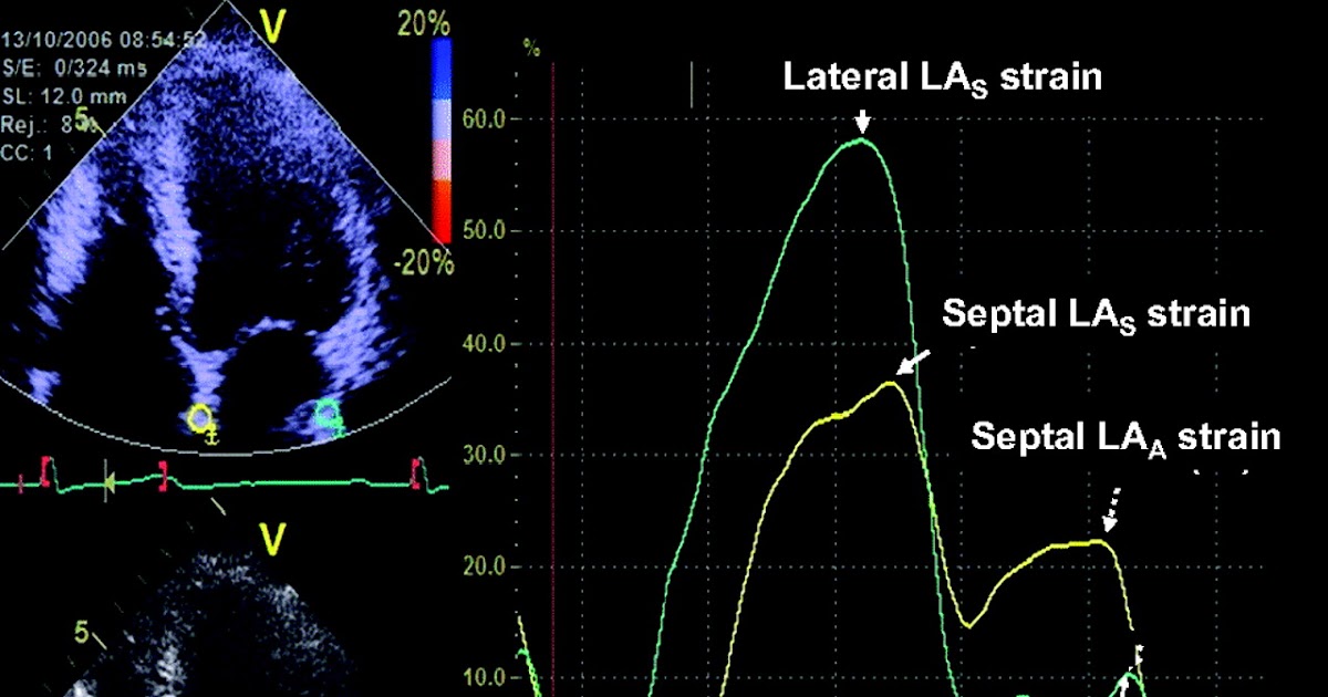Normal Lv Function Icd 10 | semashow.com