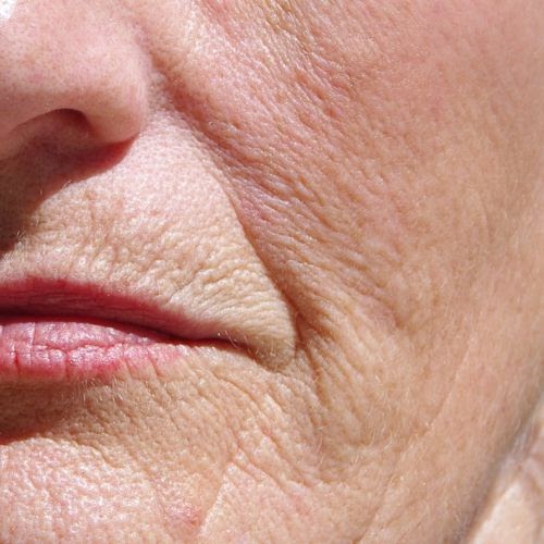 United Health Care What Are The Causes Of Mouth Lines And What You Do united-health-care-what-are-the-causes-of-mouth-lines-and-what-you-do