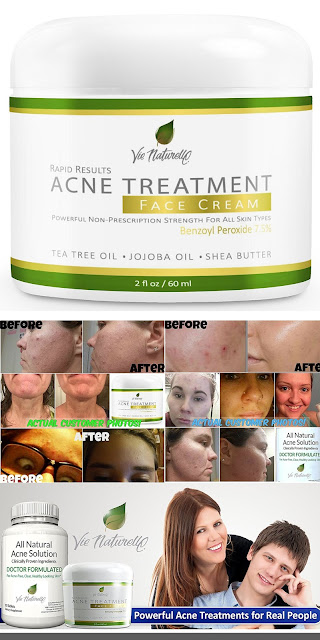 Acne | acne facial treatment,Acne Solutions and Info