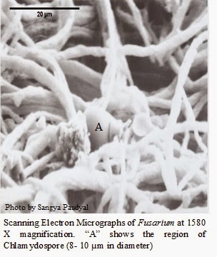 Visualization of Fusarium under Scanning Electron Microscope and ...