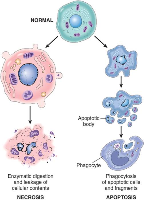 Nutrição e Informação: NECROSE E APOPTOSE