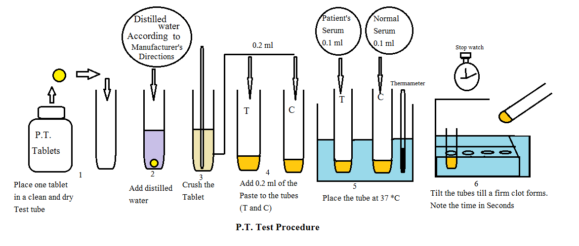mltshiksha.blogspot.com: Prothrombin Time Test by Quick's Method