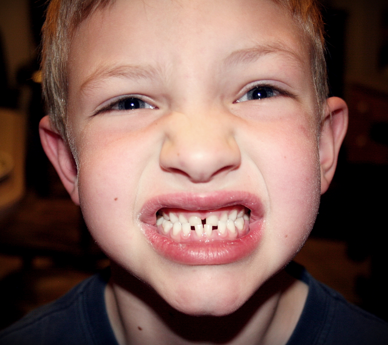 lester lou and the aarons too: Loose Tooth leads to Lost Tooth