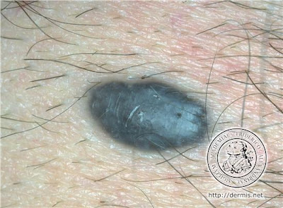 semiologia quirurgica: EXAMEN DE LA CABEZA Y CUELLO