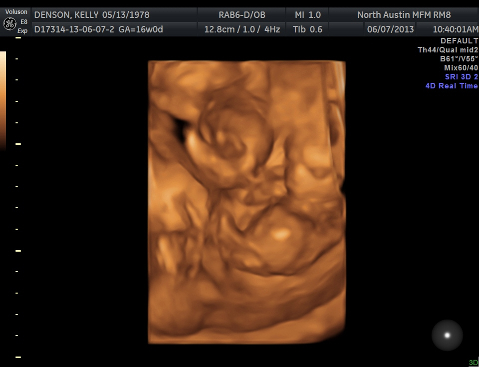 The Texas Trio: A Triplet Pregnancy Blog: 16 week ultrasound pics
