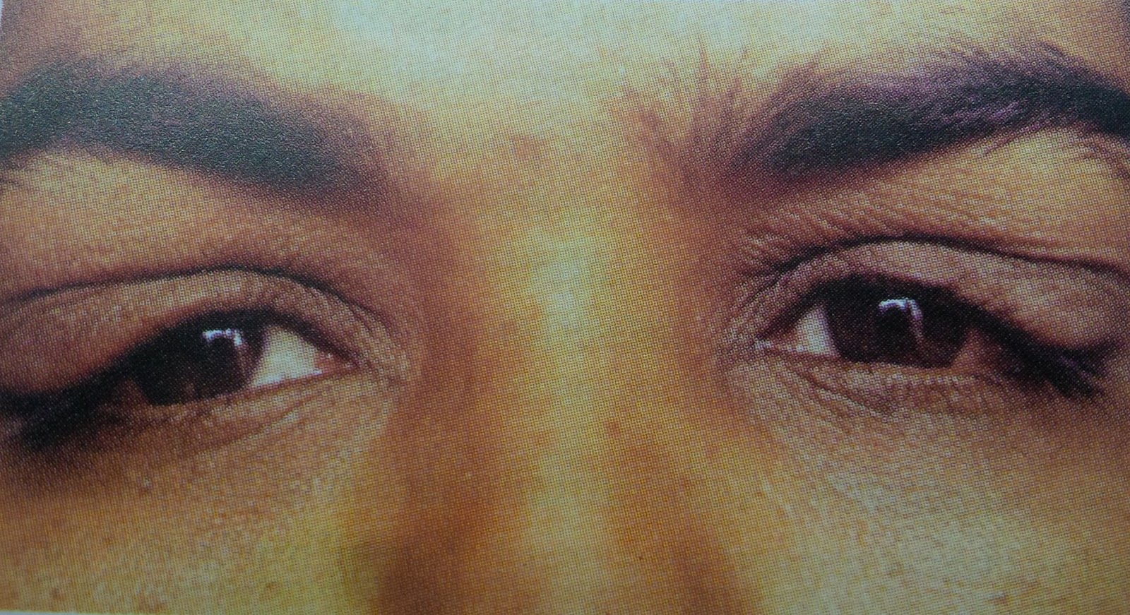 Brief Description, Types, Sign and Symptoms, Causes And Treatment Of ...