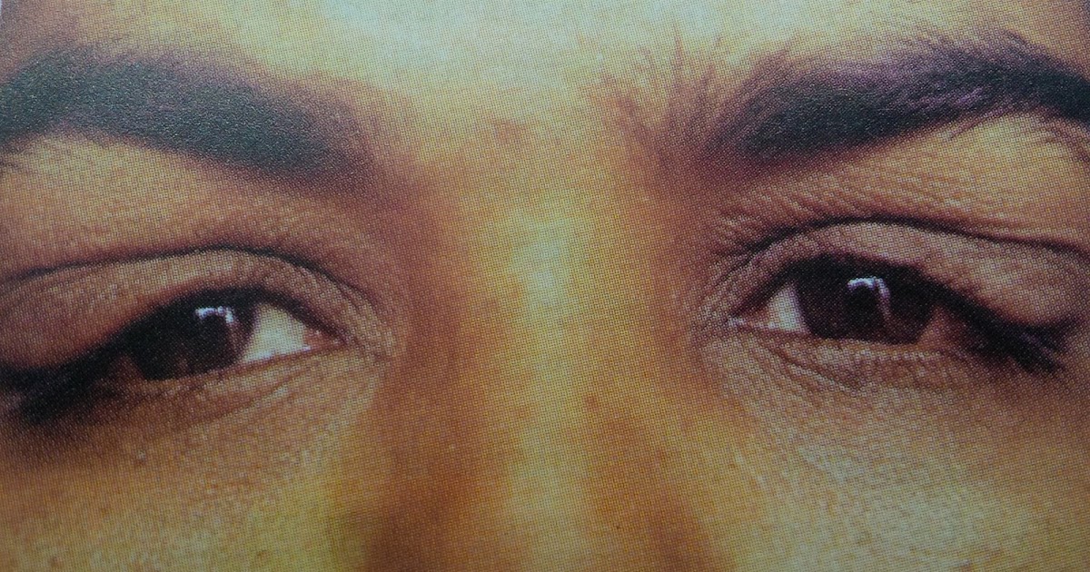 Brief Description, Types, Sign and Symptoms, Causes And Treatment Of ...