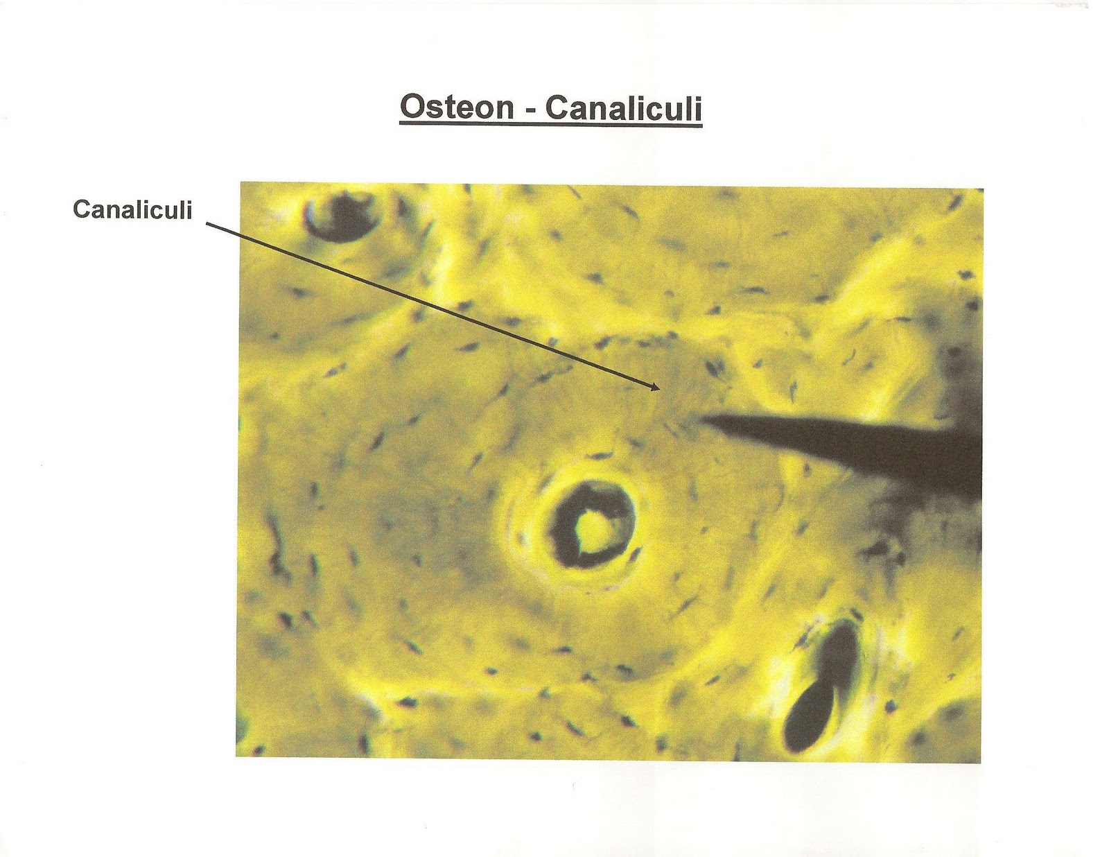 Osteon Diagram Unlabeled