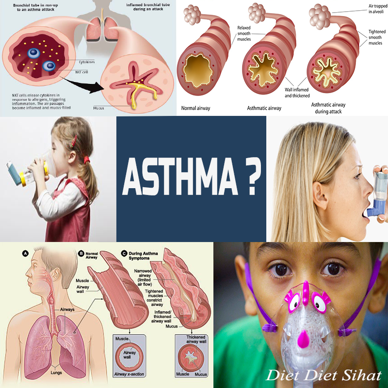 jihajumi: RAWATAN ASMA (ASTHMA)