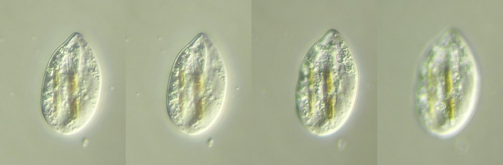 Skeptic Wonder: Marine Microforay – foram and a thecofilosean party