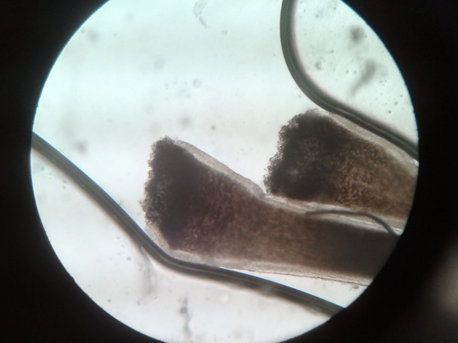 LE MICROSCOPE DU COLLÈGE WEILER (et la loupe monoculaire): PHOTOS DE ...