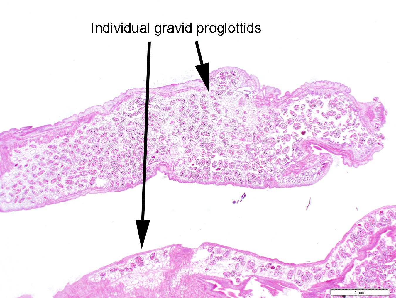Gravid Proglottid Eggs