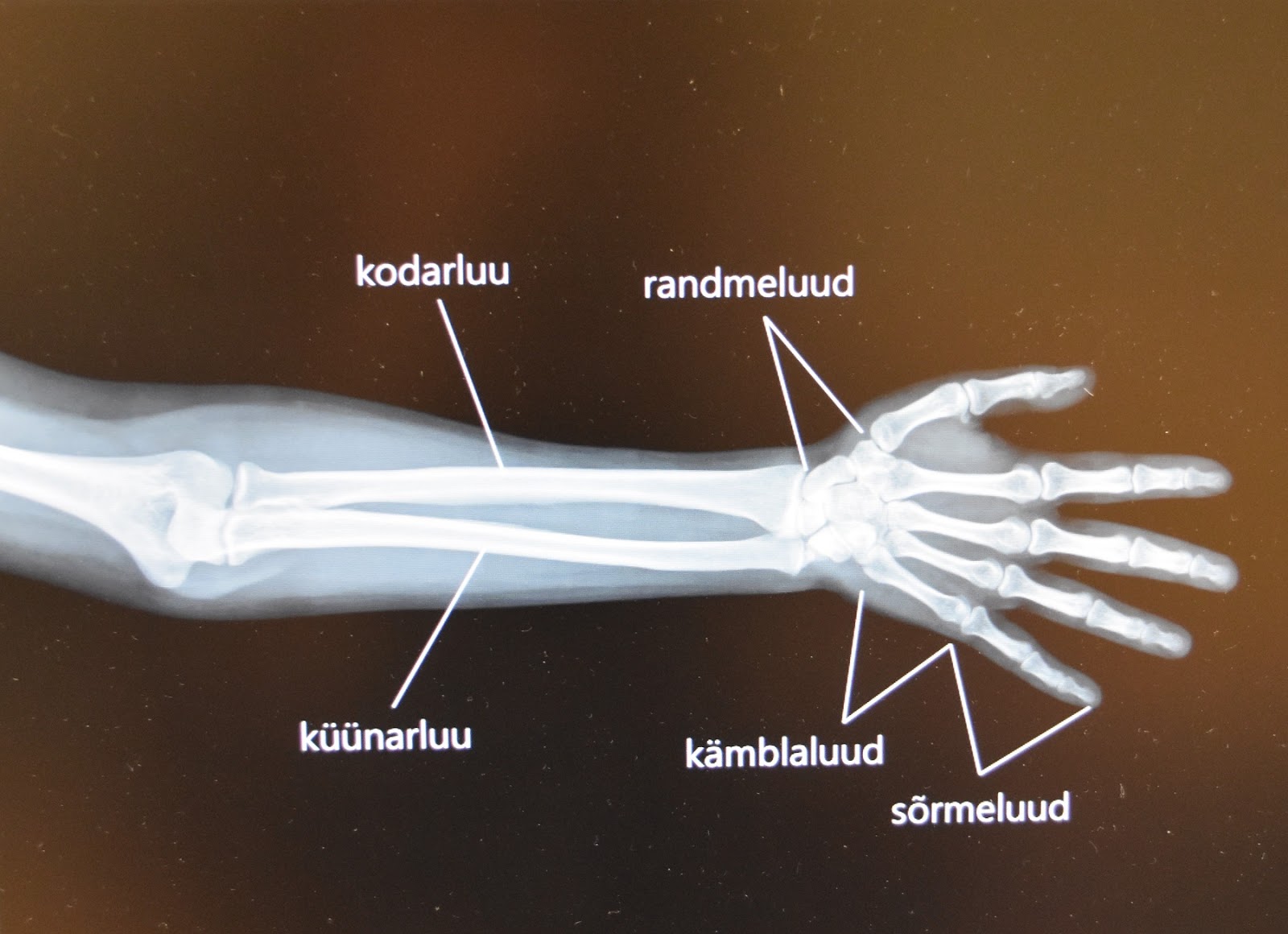 Samm-sammult tarkuse poole: Õppisime inimese luustikku