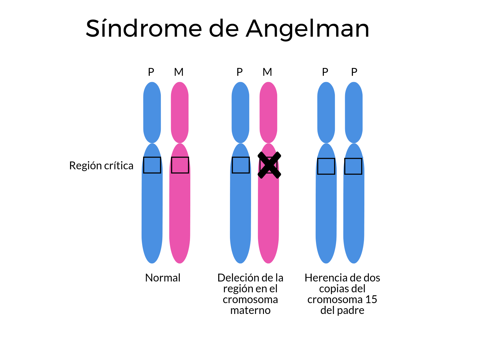El Origen de tu Herencia Genética es Importante: Síndromes de Angelman ...