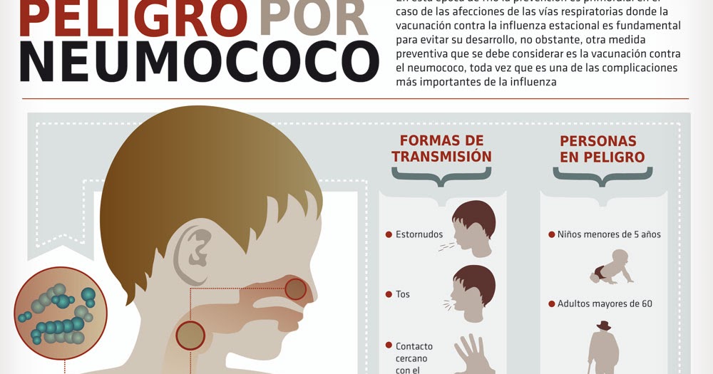 Meningitis: Meningitis por neumococo
