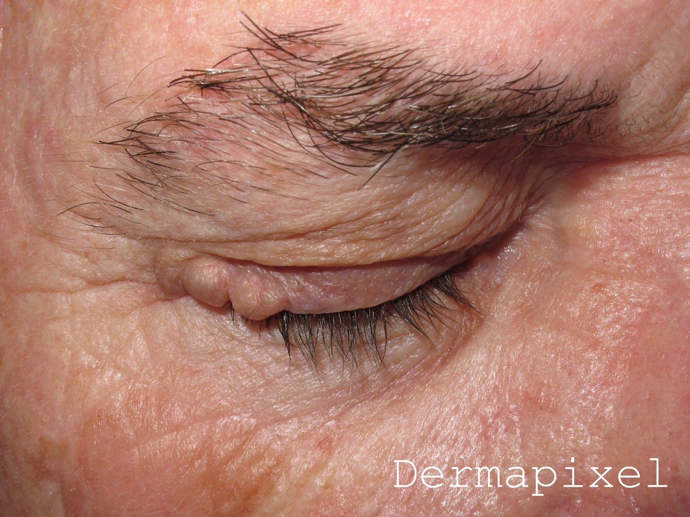 Dermapixel: abril 2013