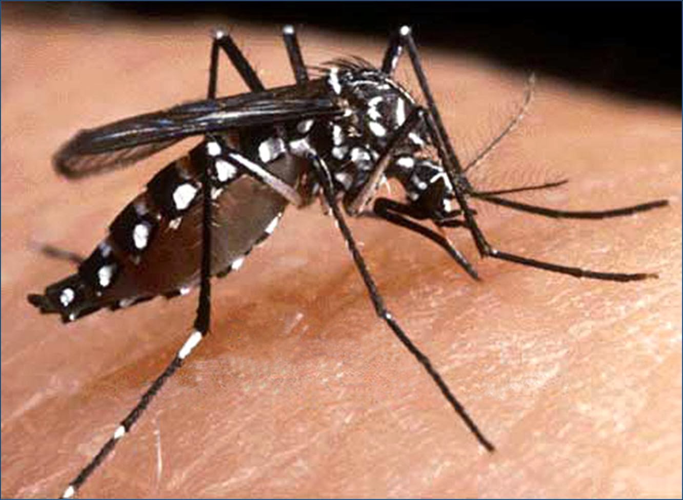 Nursing Management for Dengue Fever - Nanda Care Plan Nursing Management for Dengue Fever - Nanda Care Plan