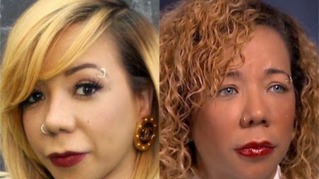 Tameka "Tiny" Harris Plastic Surgery Eyes